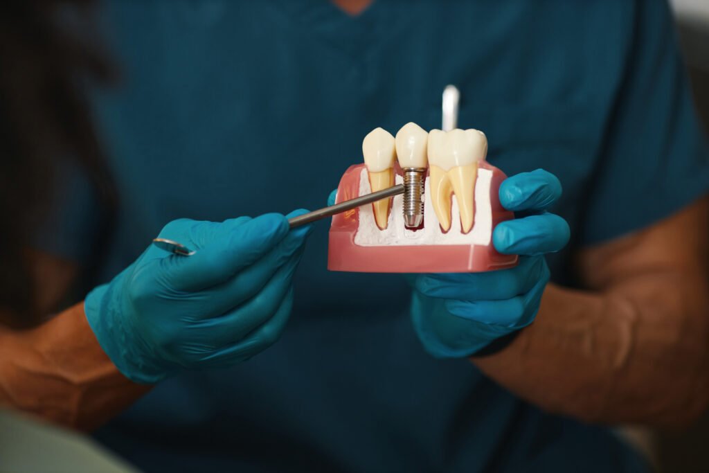 DENTAL IMPLANTS – drsukkeshdental